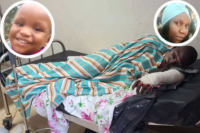 Hoima Family Tragedy: Woman and Husband Succumb to Fire Burns