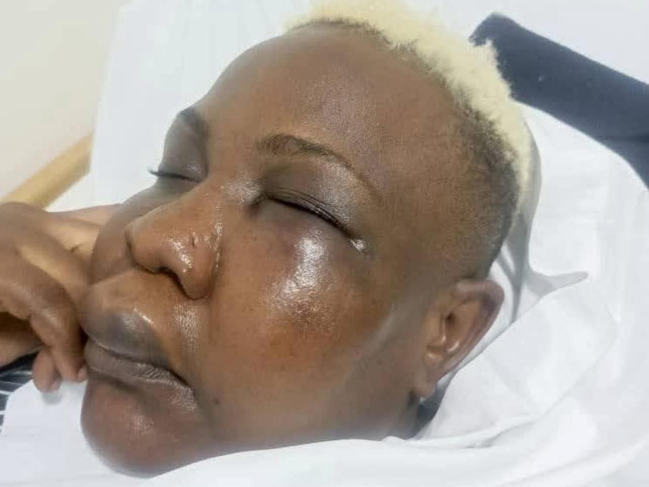 Full Figure Brutally Attacked in Kampala