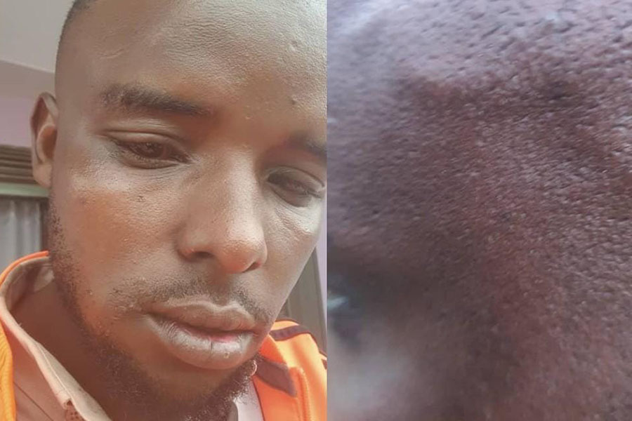 KCCA Takes Action After NBS Journalist Assaulted, Suspect Arrested