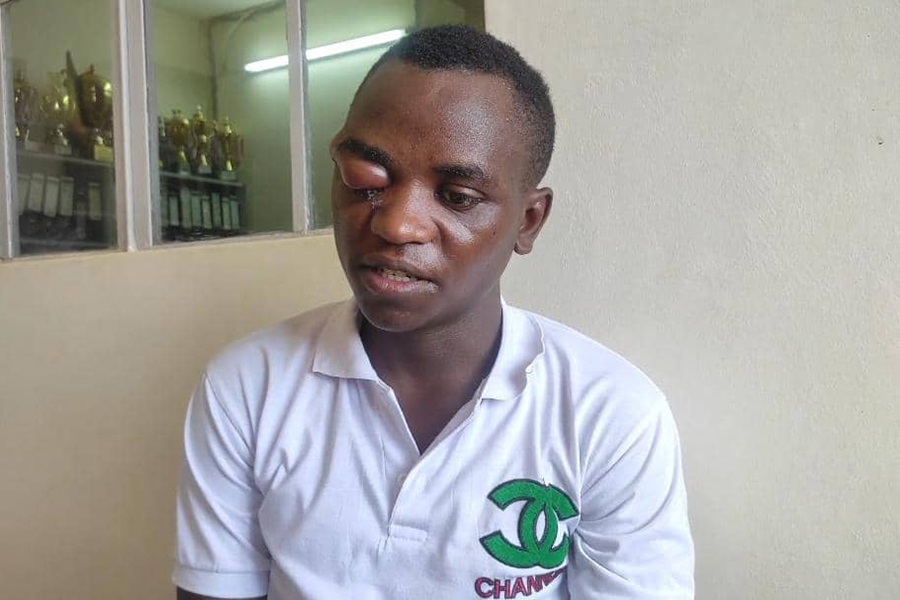 Brutal Machete Attack on Student Sparks Security Concerns at Bishop ...