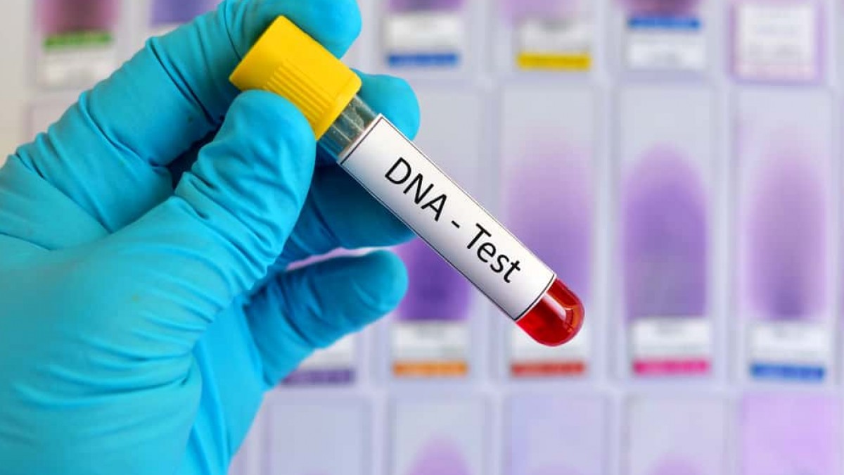 Govt directed on DNA testing as more dads seek services