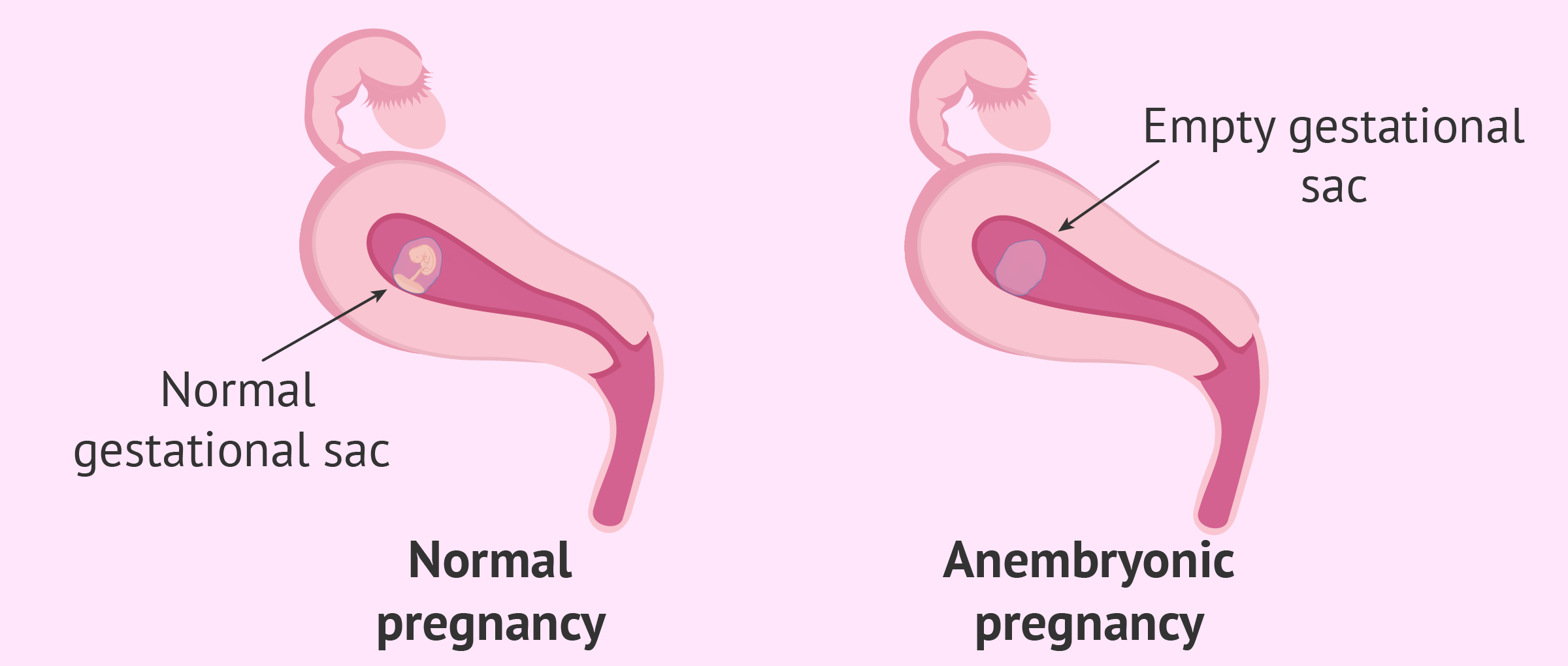 Preventing Blighted Pregnancy Steps Towards Healthier Pregnancies And preventing-blighted-pregnancy-steps-towards-healthier-pregnancies-and