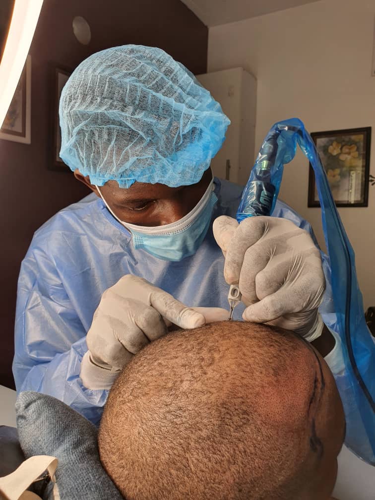 Scalp Micro pigmentation: the practical solution to your breaking and ...